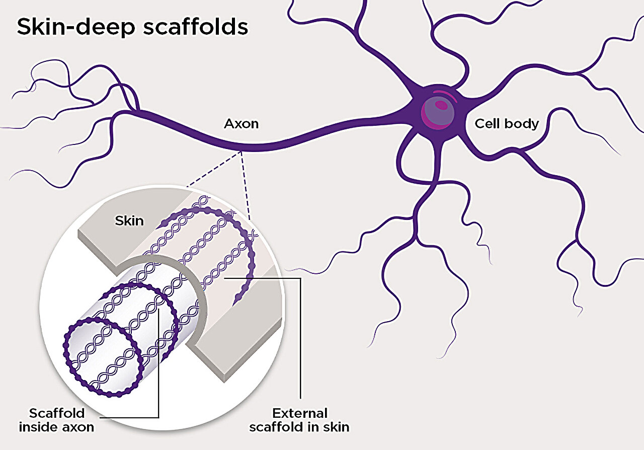Pleasure and pain: Tiny worm reveals secret to protecting skin sensations
