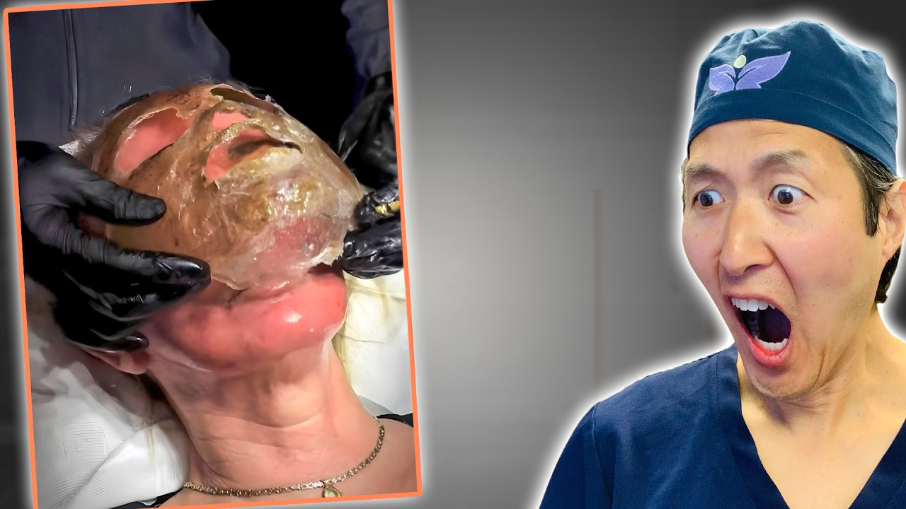 Plastic surgeon reacts to dangerous phenol face treatments