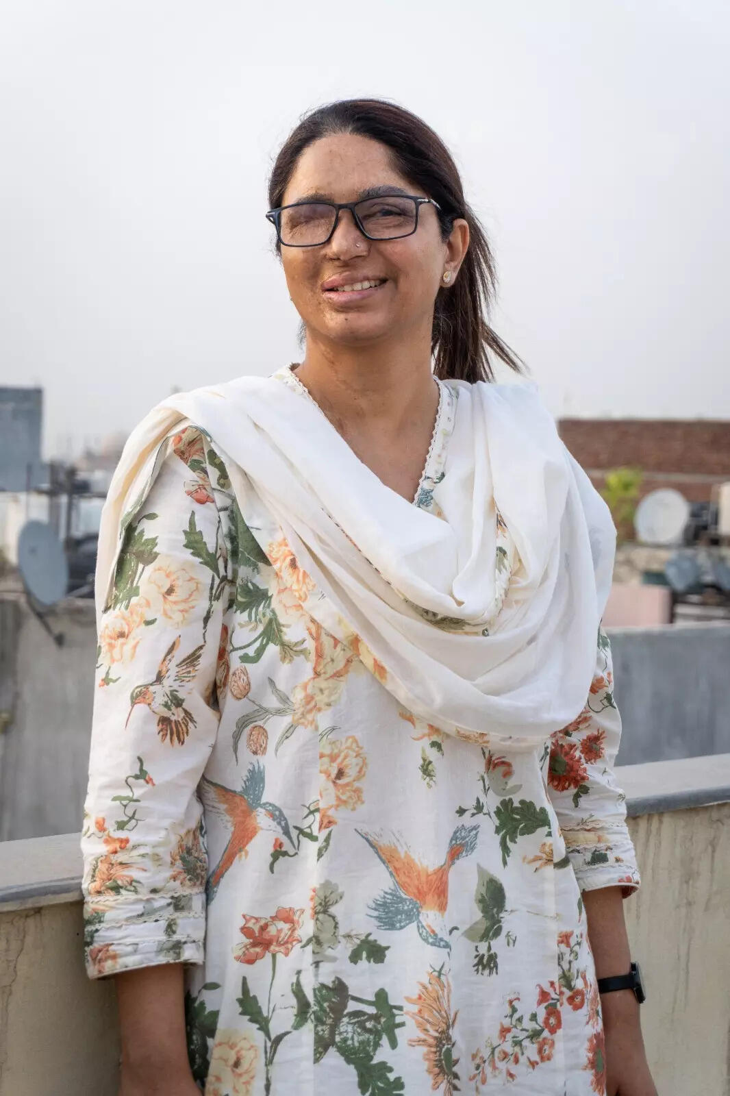 Have to live with scars for life but will fight on: Acid attack ...