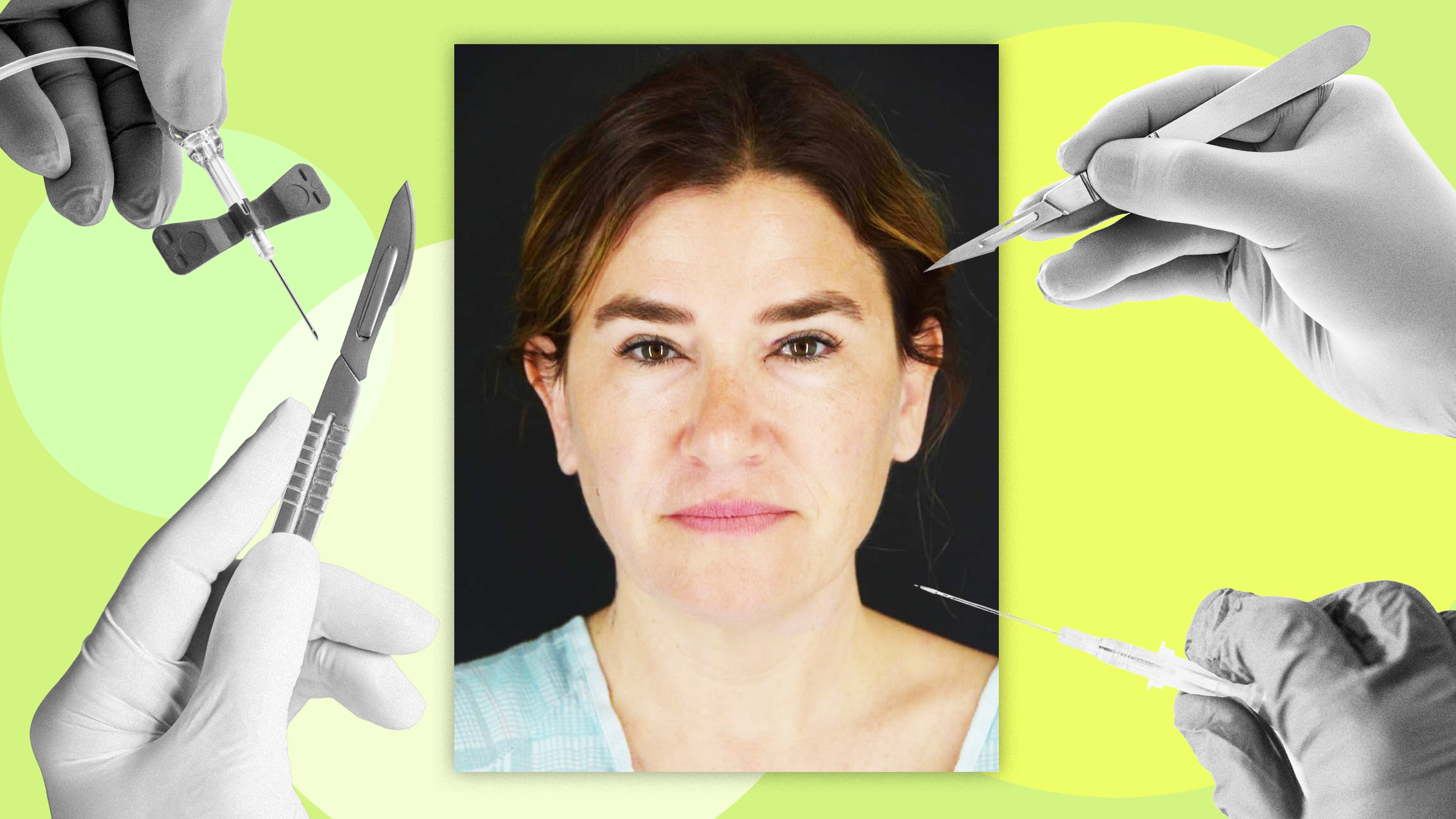 How this woman in her late 40s got dramatic results without a facelift