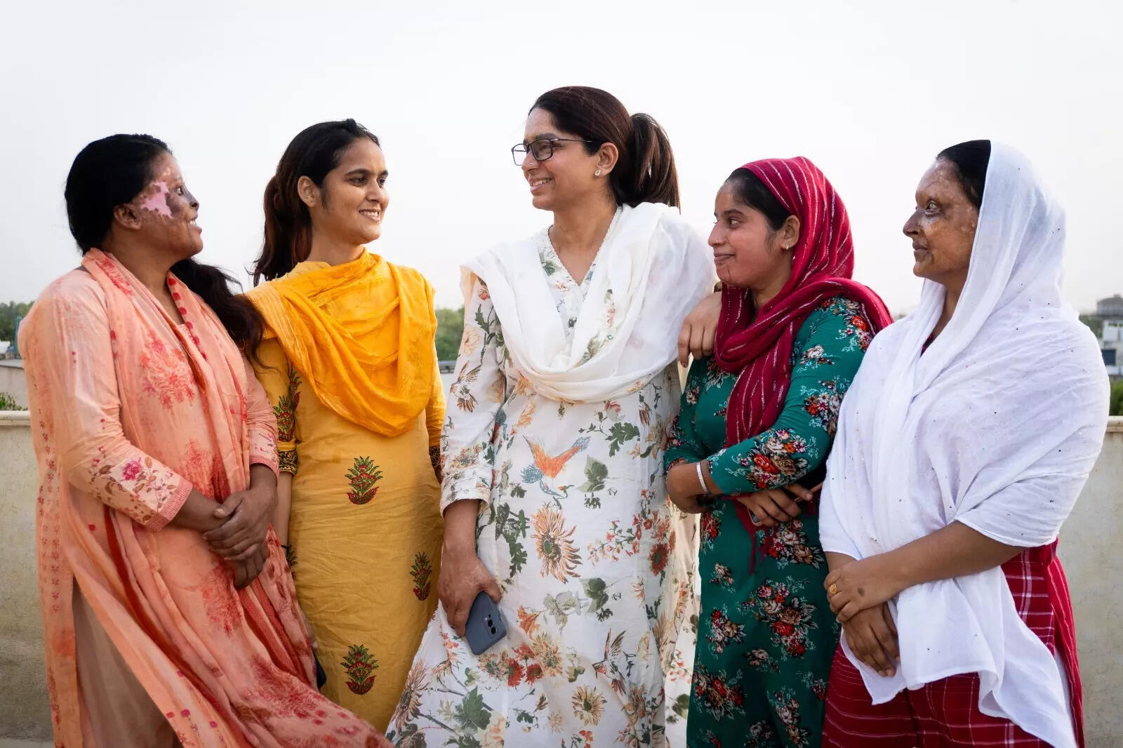 Have to live with scars for life but will fight on: Acid attack ...