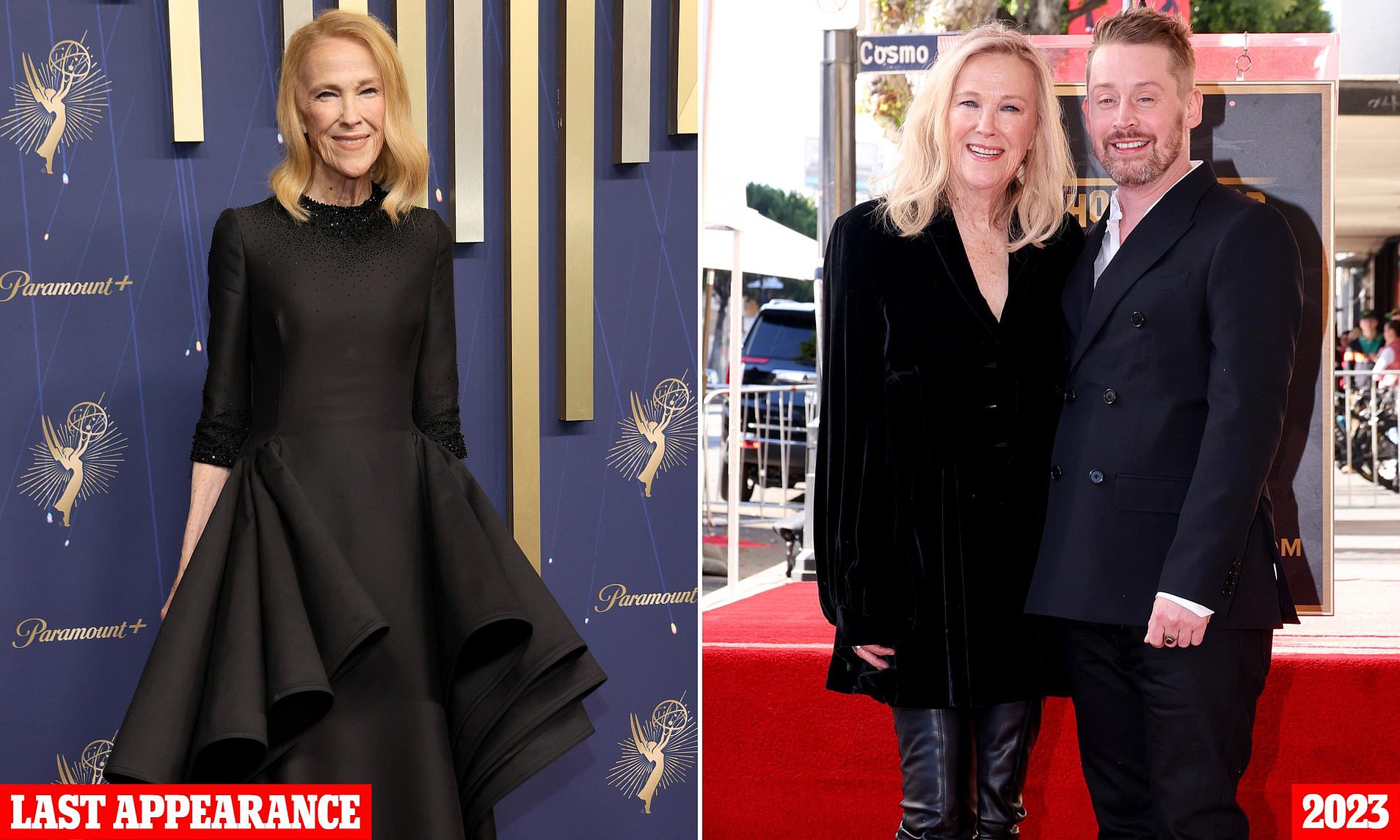 The rare condition suffered by Catherine O'Hara that only impacts one ...