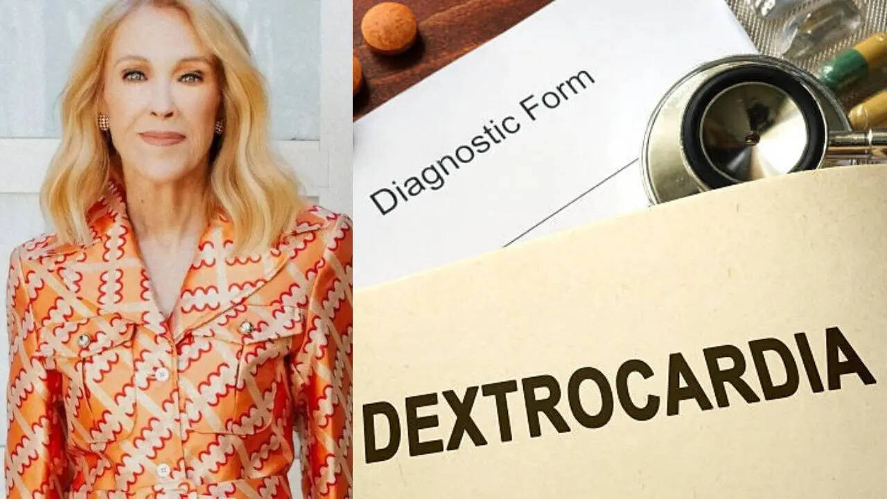 Catherine O’Hara dies: Understanding dextrocardia, the rare heart ...