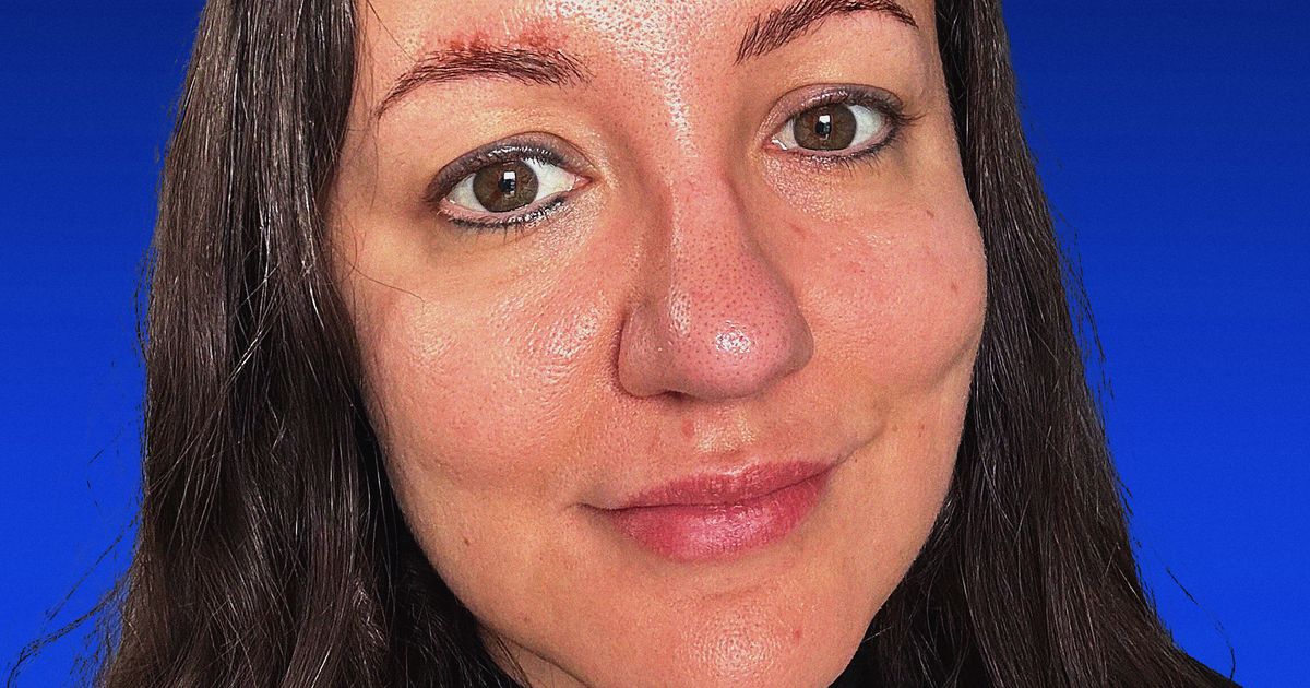 I am desperate to get rid of my permanent eyeliner