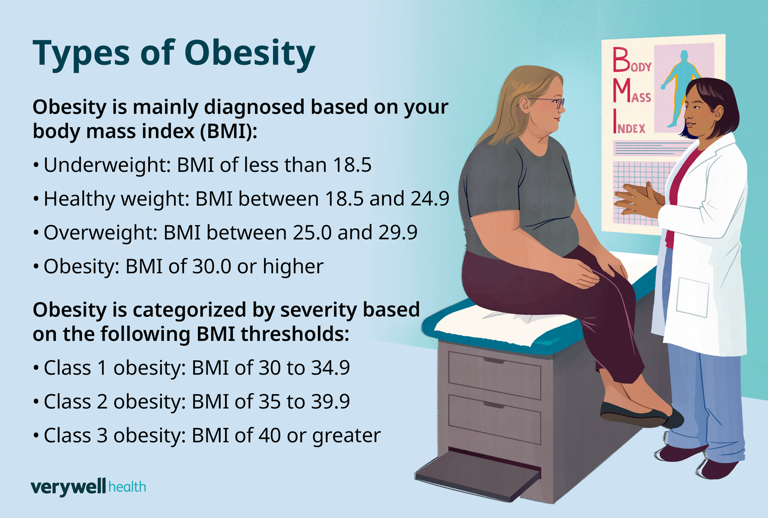 Three classes of obesity: Each category explained