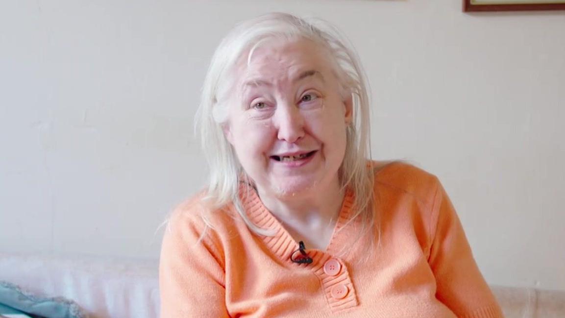 Stroke survivor calls free home care scheme 'transformational'