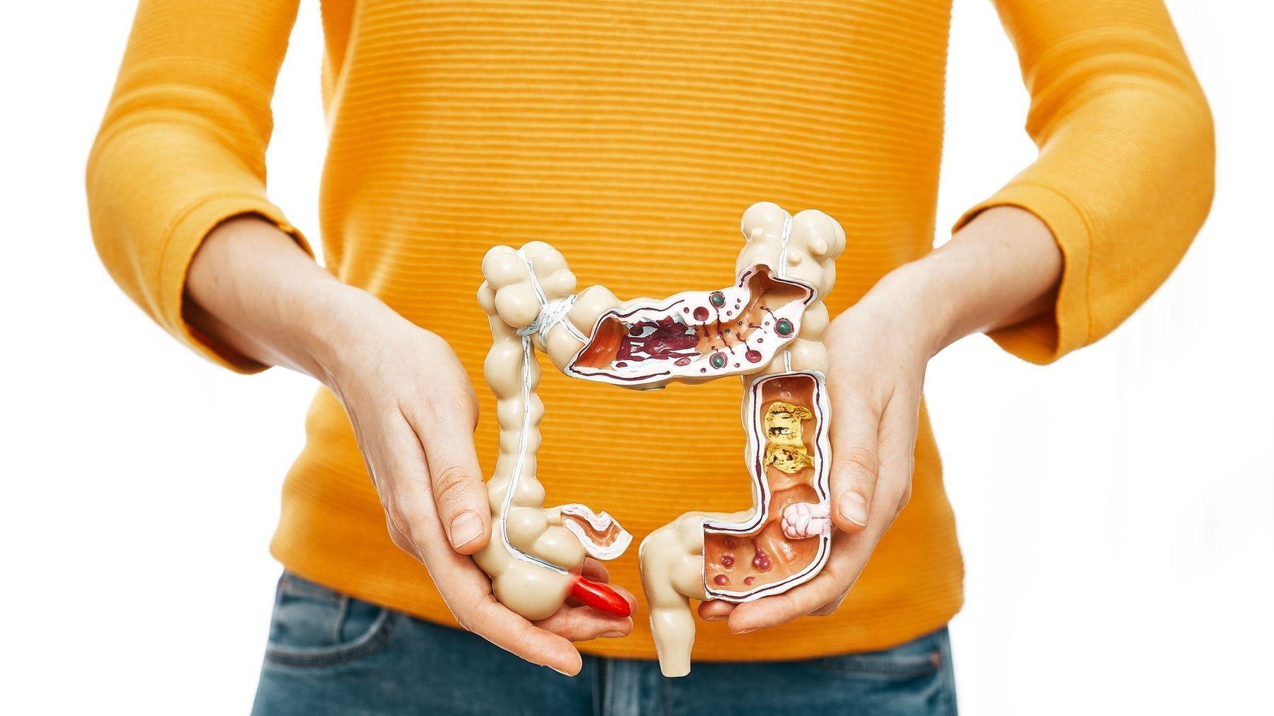Warning signs of colon cancer you need to know