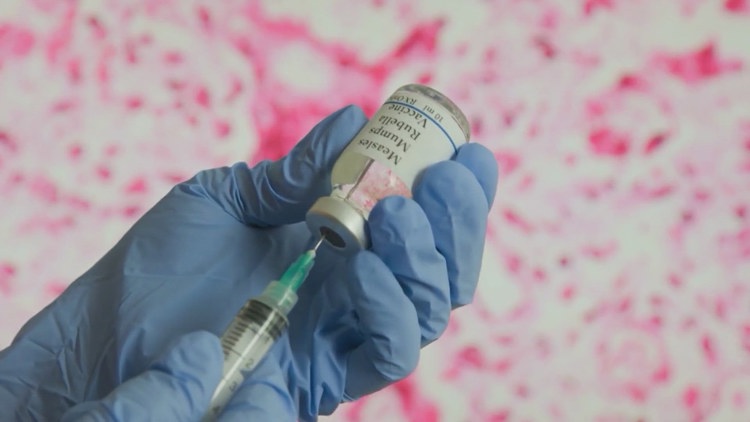 Measles case reported in Boerne, city officials say