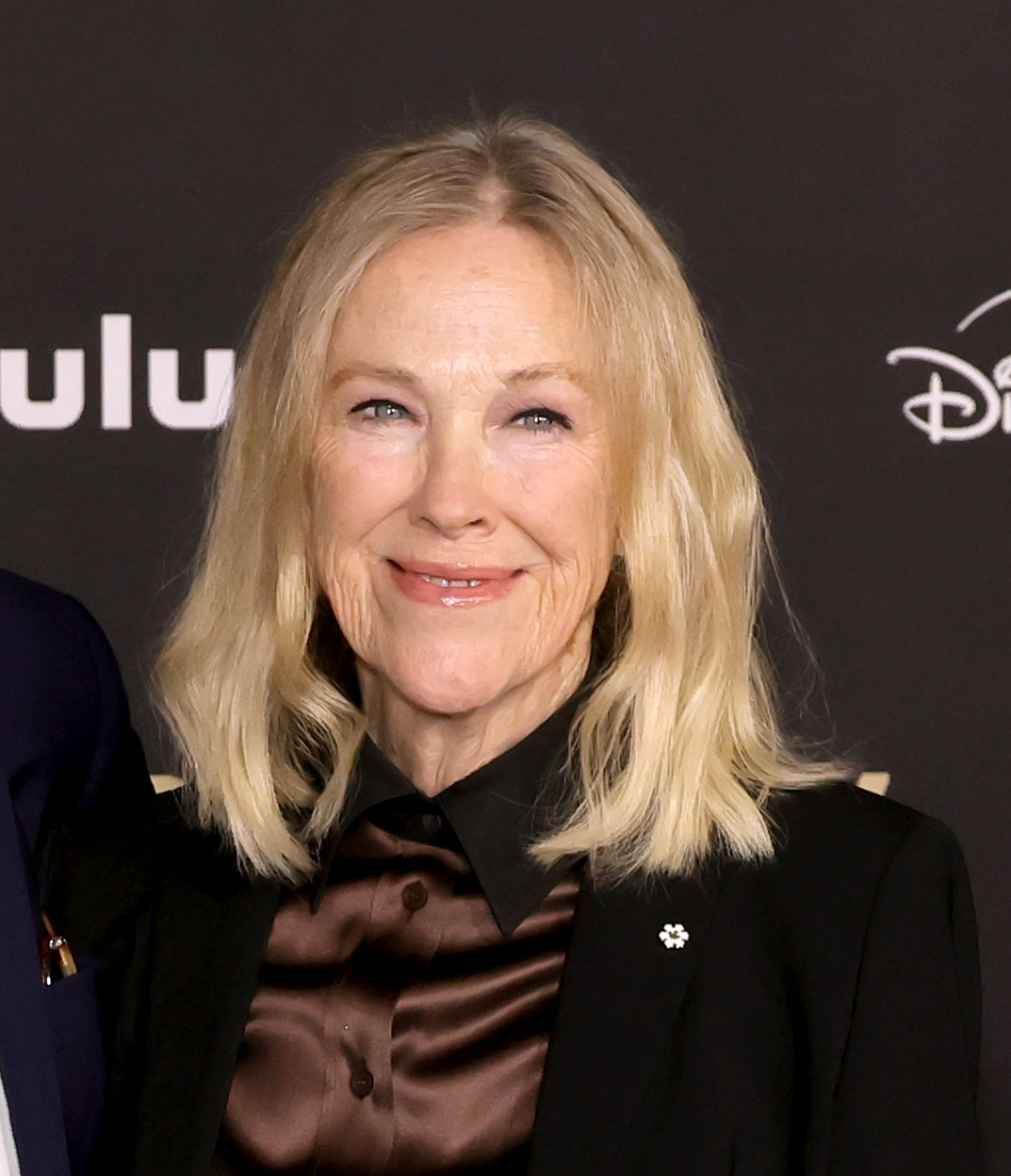Rare condition that flipped Catherine O’Hara’s organs around is explained