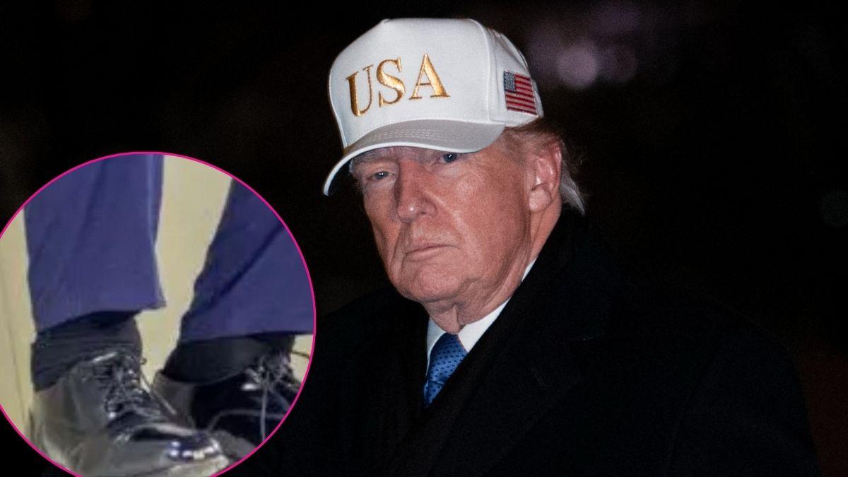 Donald Trump accidentally exposes cankles again after horrifying new ...