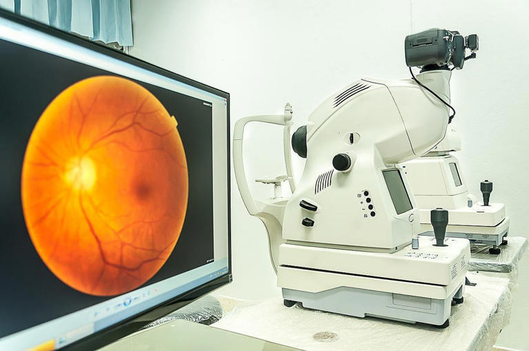 Retinal photographs can ID regions of retina linked to Alzheimer ...