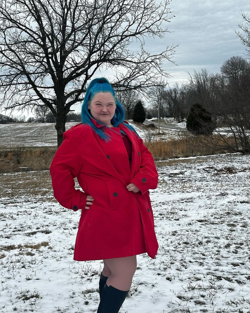 Why Amy Slaton's body bothers her more after 200-pound weight loss