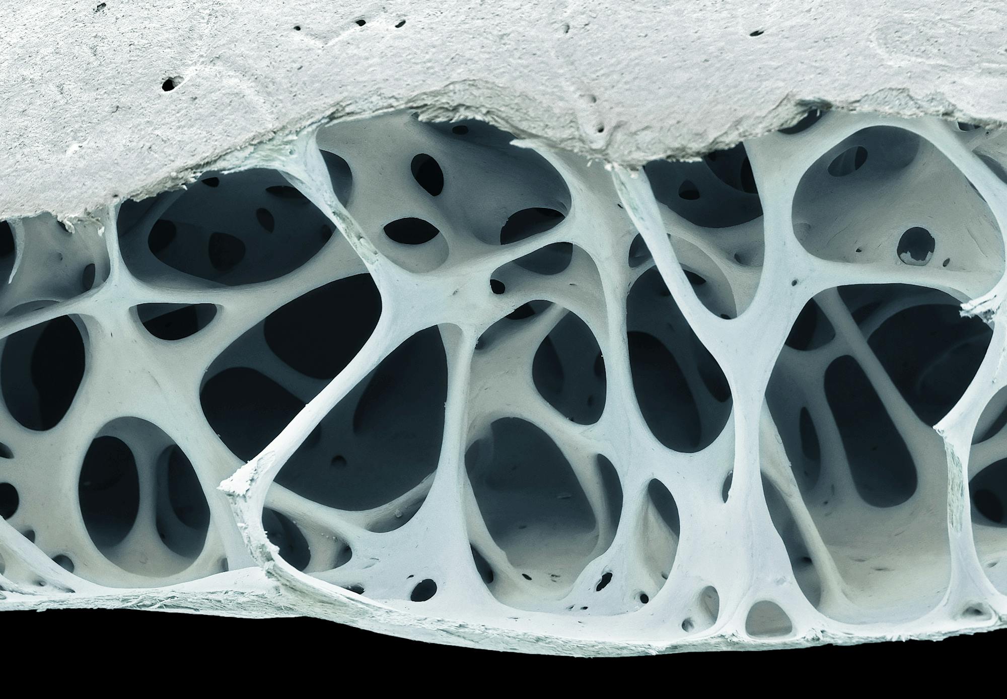Building with air – how nature’s hole-filled blueprints shape manufacturing