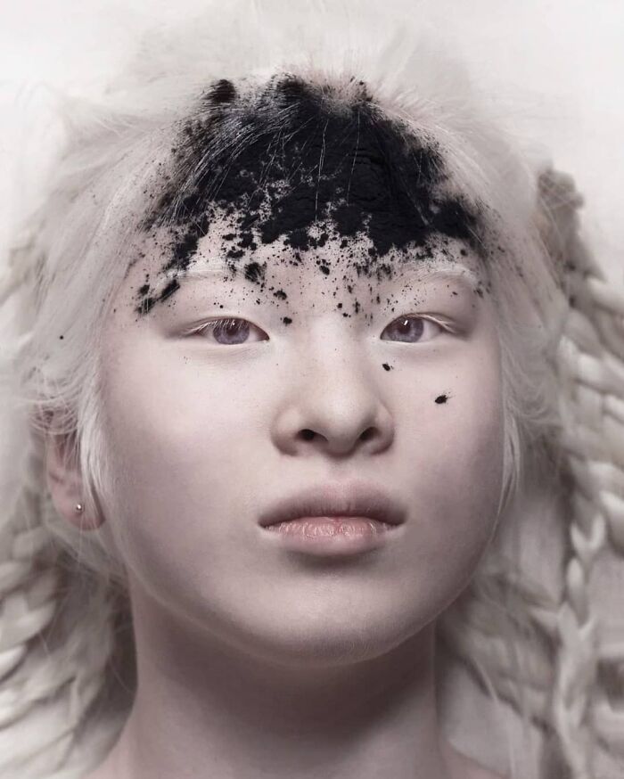 Abandoned as a baby due to albinism, Xueli grew up to become a Vogue ...