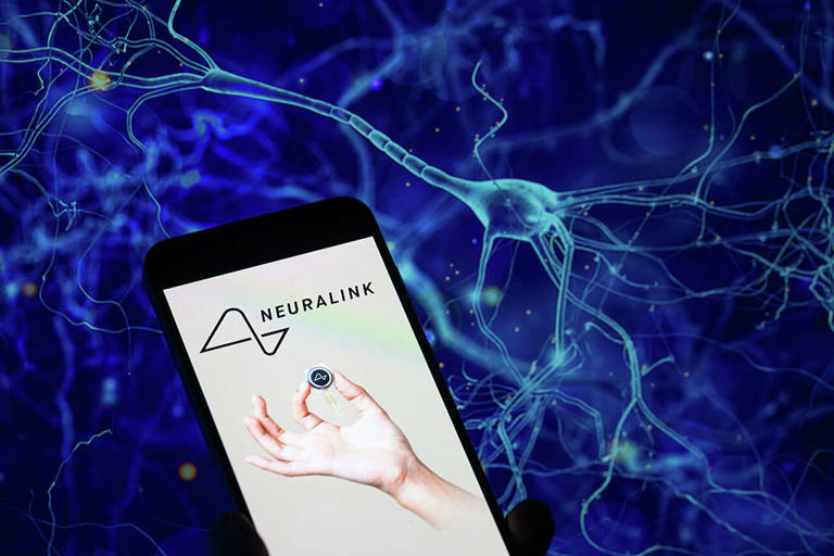 Elon Musk's brain implant company sets $8.2M upgrade in Texas