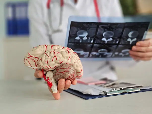 Cientistas analisam presença de bactéria nos olhos de pacientes com ...