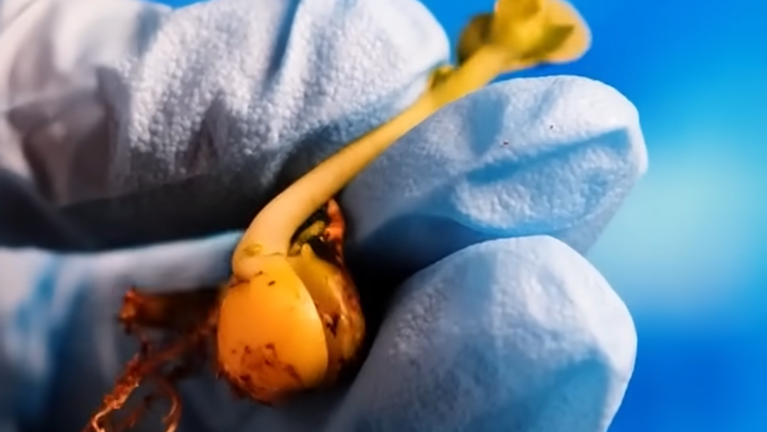 Doctors found a living plant growing inside this man’s lung