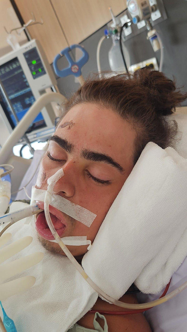 Brain scans in Thailand show much-needed hope for accident victim Tiger ...