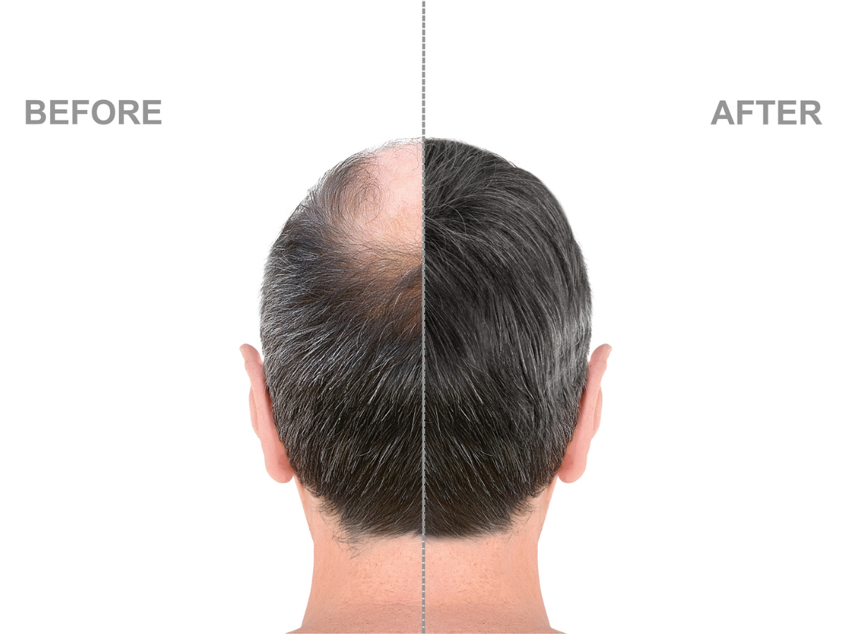 Hair regrowth herb: Study says this ancient medicinal root could help ...