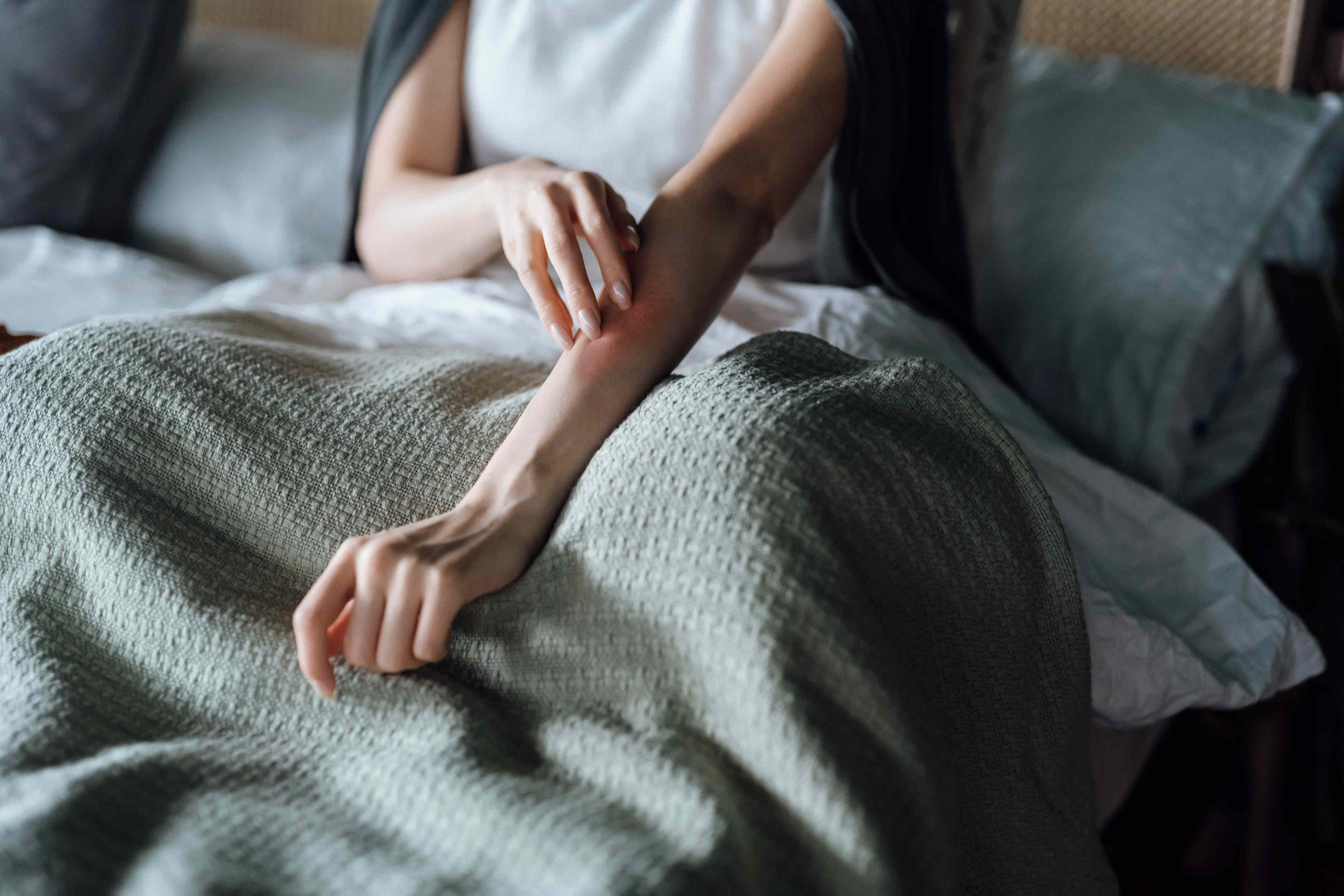 Is chronic spontaneous urticaria (CSU) an autoimmune disease?