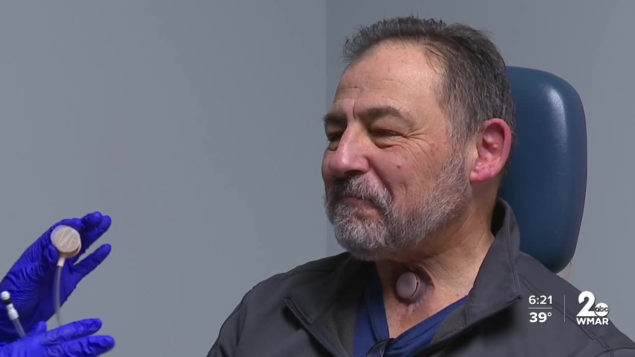 Cancer survivor gets new voice after vocal cord removal surgery