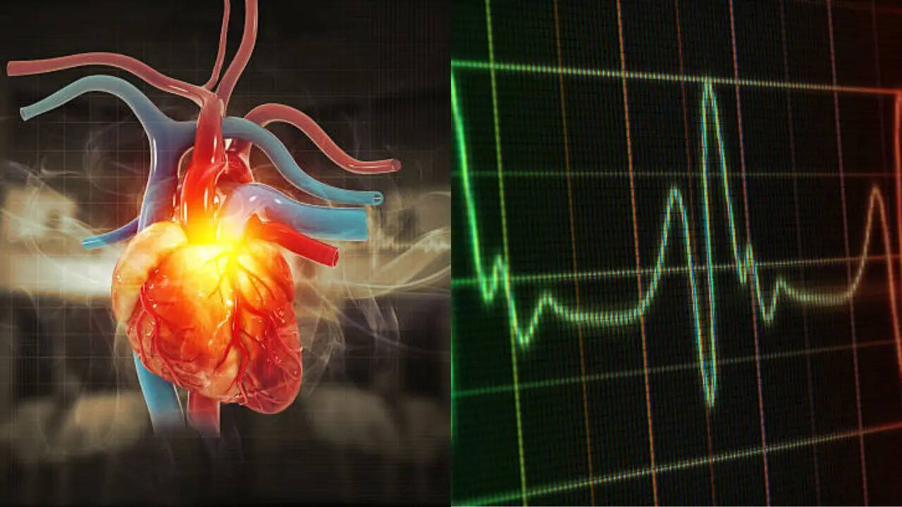 No chest pain? Why silent heart attacks often go undetected