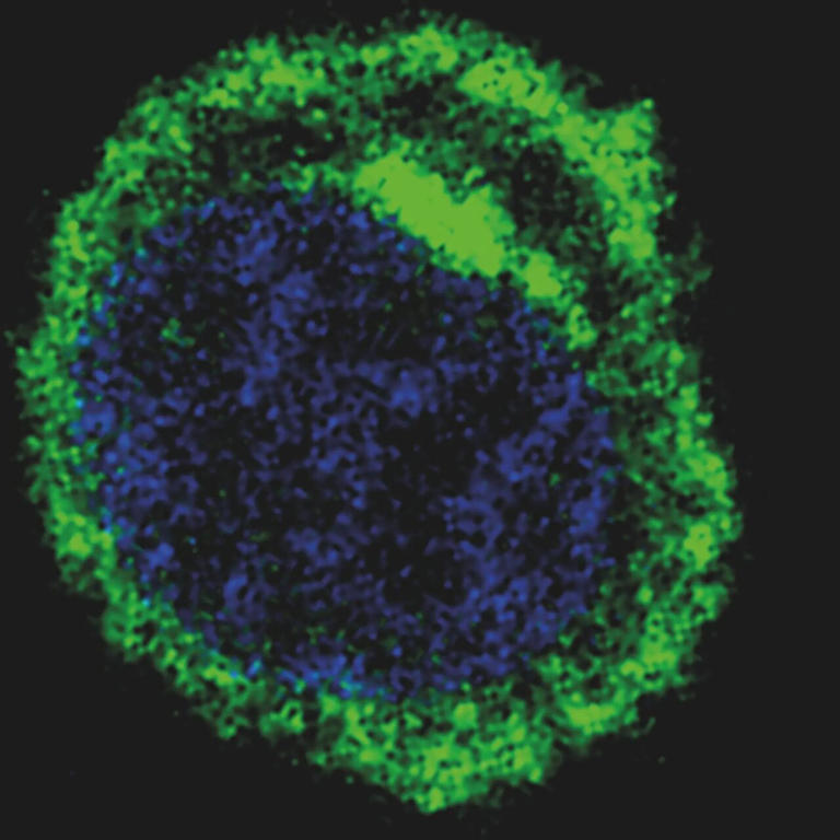 Established cancer drug can reactivate immunotherapy