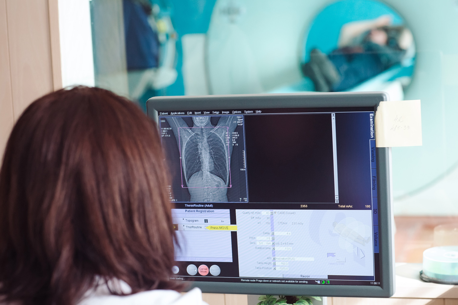 Cancer screening tests: When should you do them?