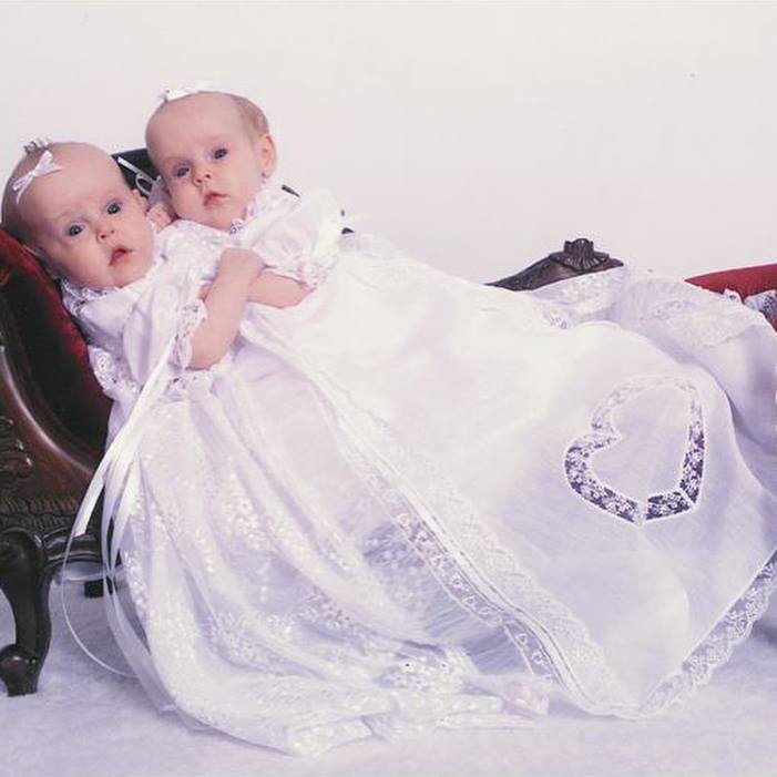 Born joined, living separate lives: The Herrin twins