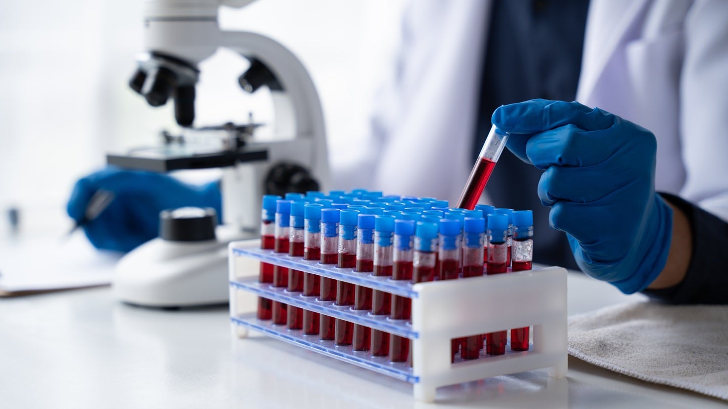 Janux commences participant dosing in phase I JANX011 trial