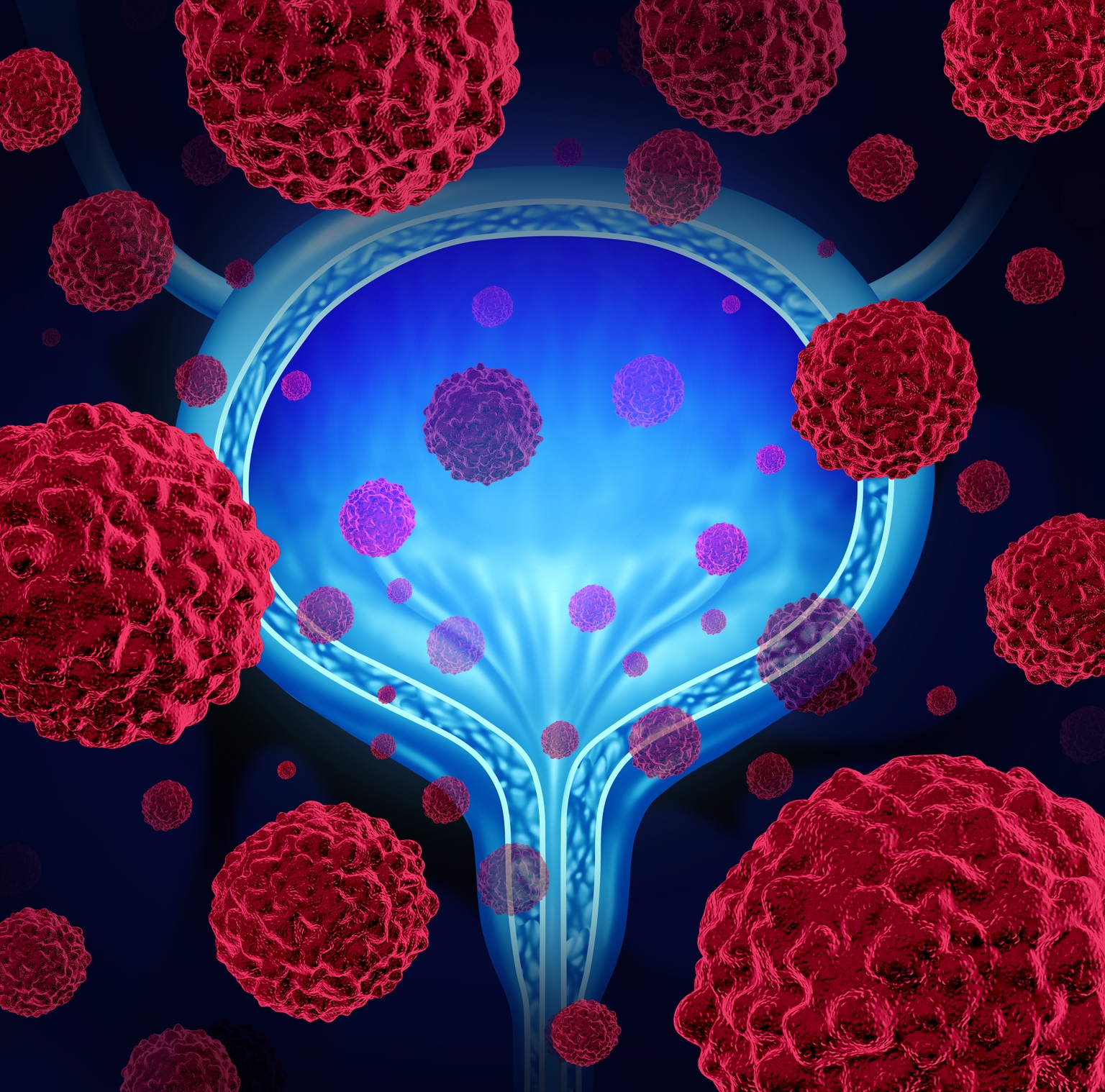Merck gains EU approval of Keyruda, Padcev combo for bladder cancer