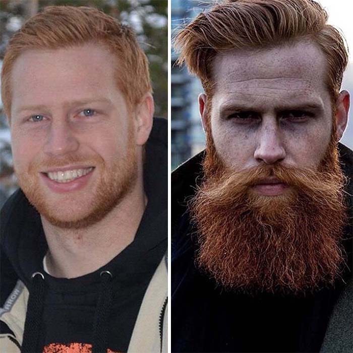 29 men who are now rocking a bearded look share how they looked before