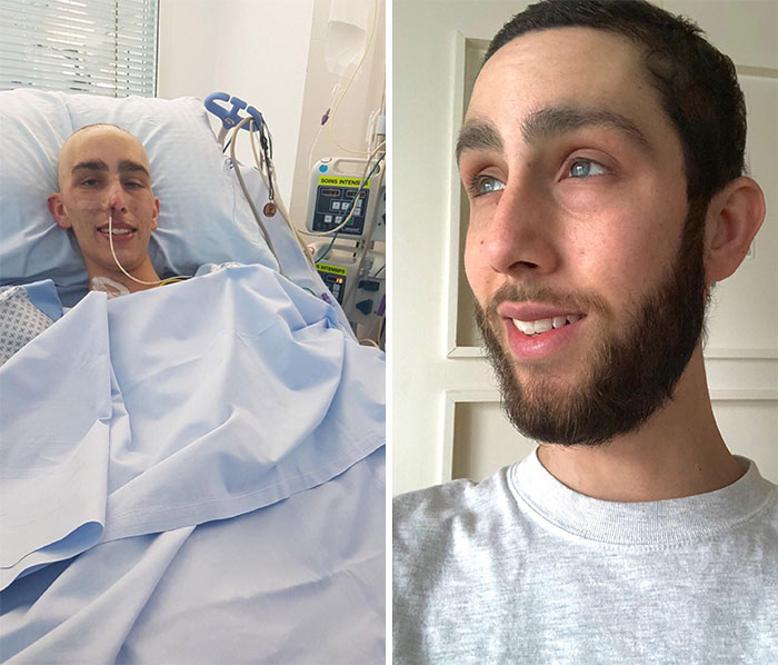 29 men who are now rocking a bearded look share how they looked before