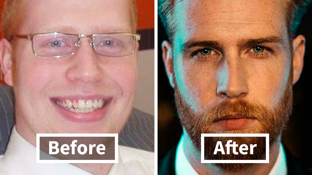 29 men who are now rocking a bearded look share how they looked before