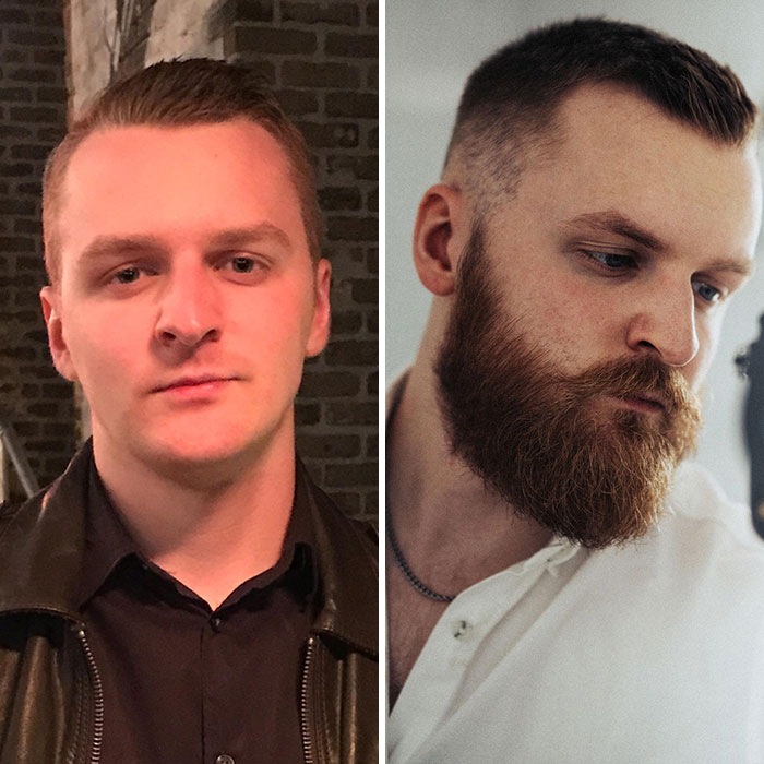 29 men who are now rocking a bearded look share how they looked before