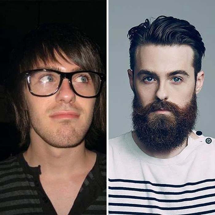 29 men who are now rocking a bearded look share how they looked before