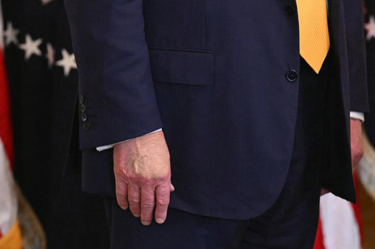 Trump compared to 'rotting orange' after spotted with makeup covering ...