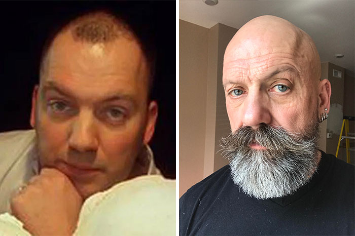 29 men who are now rocking a bearded look share how they looked before
