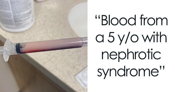 26 interesting medical cases that might make you appreciate the human body