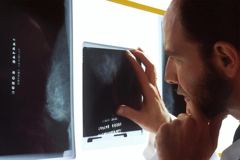 Low-dose drug cuts breast density up to 26% with fewer side effects