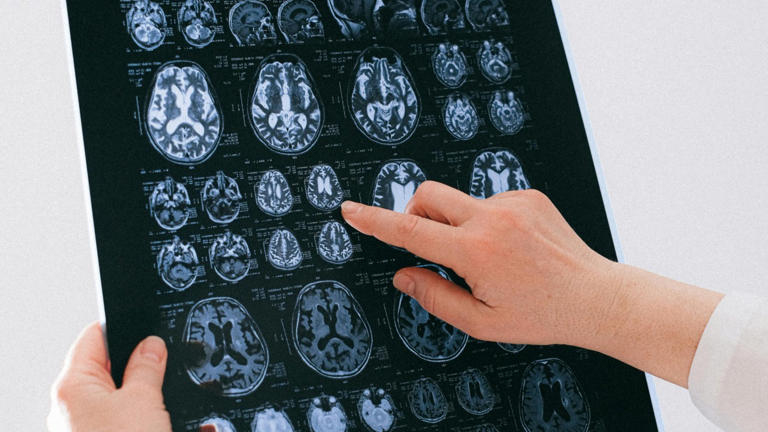 Scientists uncover how exercise shields the brain from damage