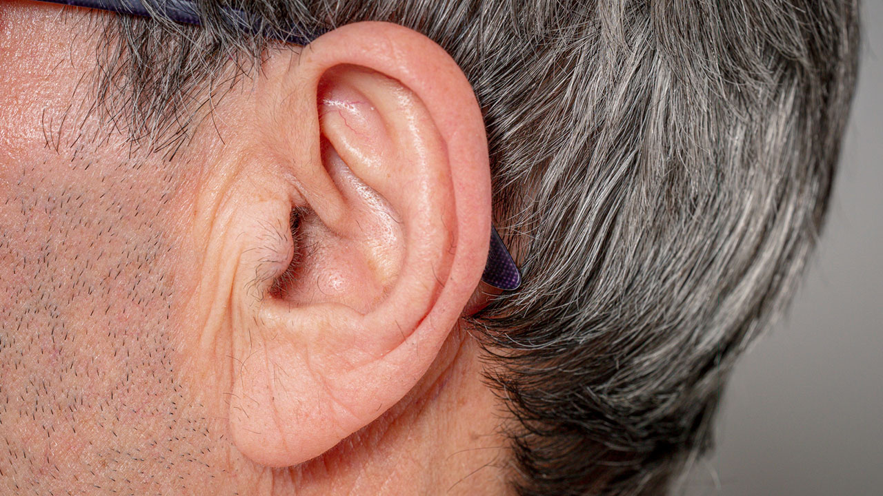 Why do I have so much ear hair? Causes, age effects, and removal options