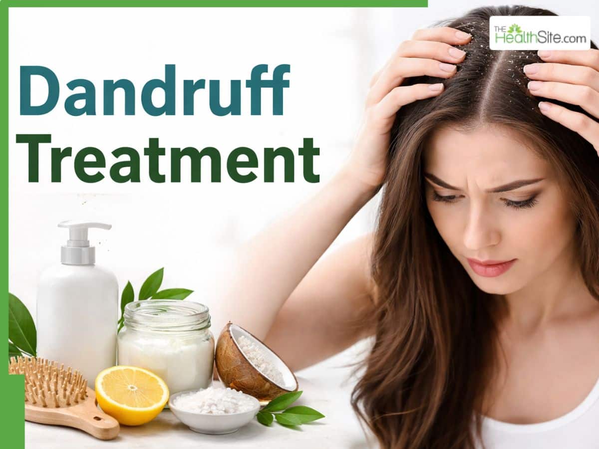 Dandruff treatment: 7 scalp cleaning habits to get rid of flakes ...
