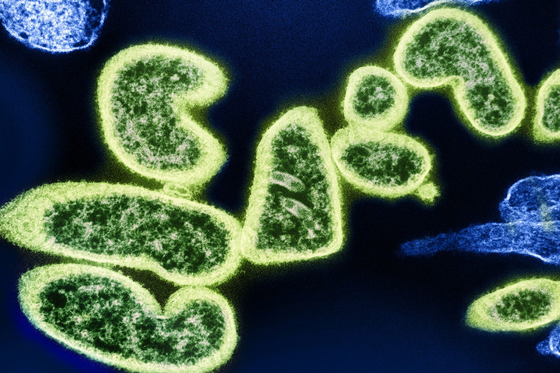 5,000-year-old cave bacteria discovered that may heal infections