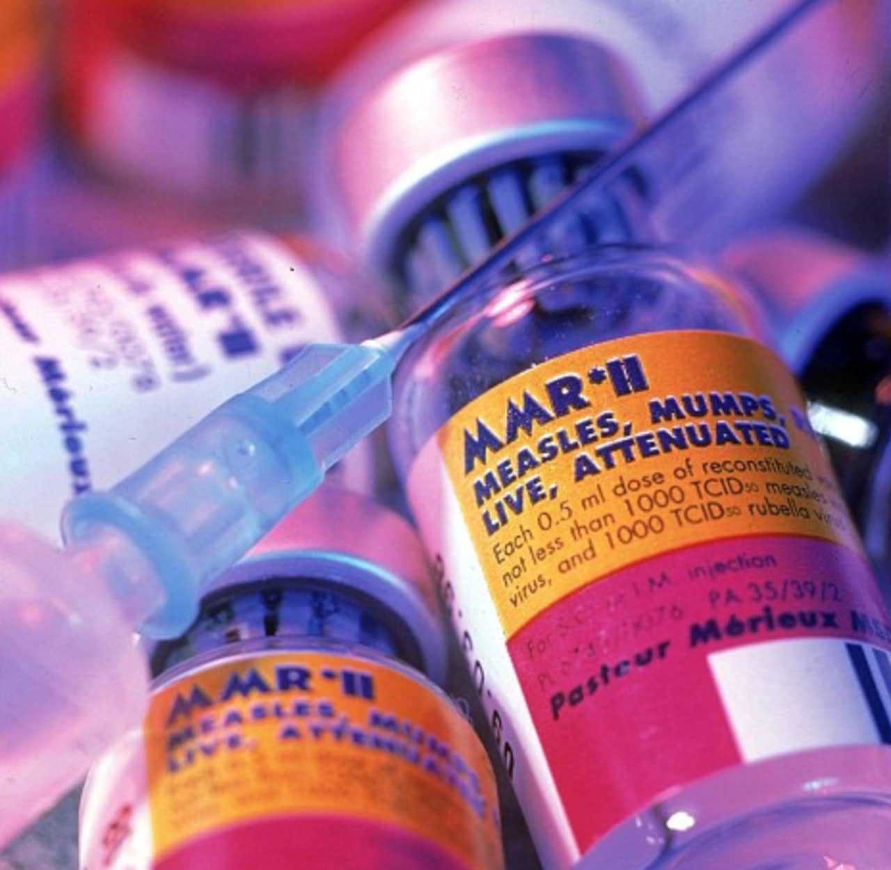 Mumps Cases In Maryland Triple All Of 2025 Just Weeks Into The New Year ...