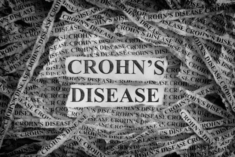 Eli Lilly unveils long-term data on Omvoh for Crohn's disease
