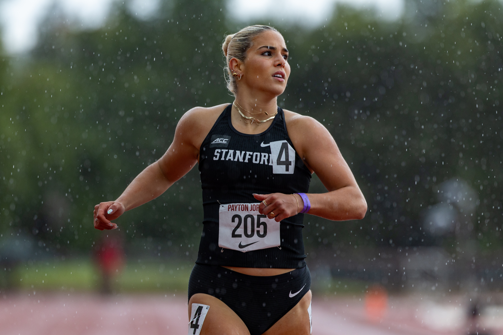 This Stanford runner's foot was amputated after a road race at age 6 ...