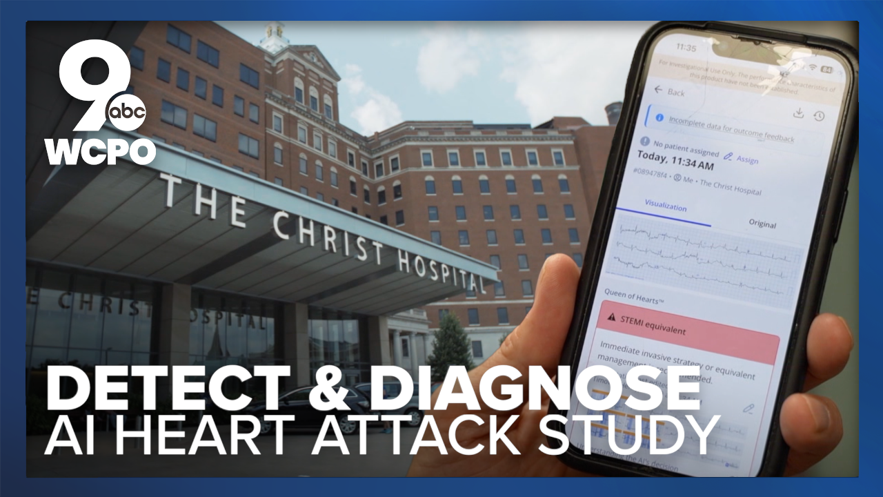 Studies show AI technology helps doctors detect severe heart attacks ...