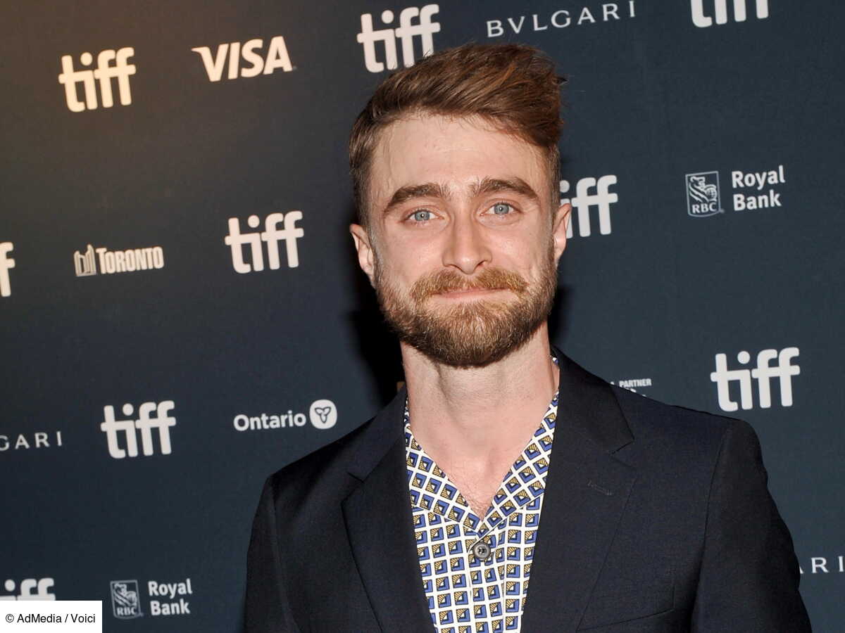 Daniel Radcliffe : pourquoi il pense que Dominic McLaughlin sera ...