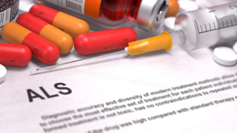 ALS diagnosis: Symptoms, progression, and survival rates explained